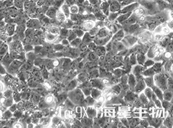 SUM149PT细胞/人乳腺癌细胞(SUM149PT)